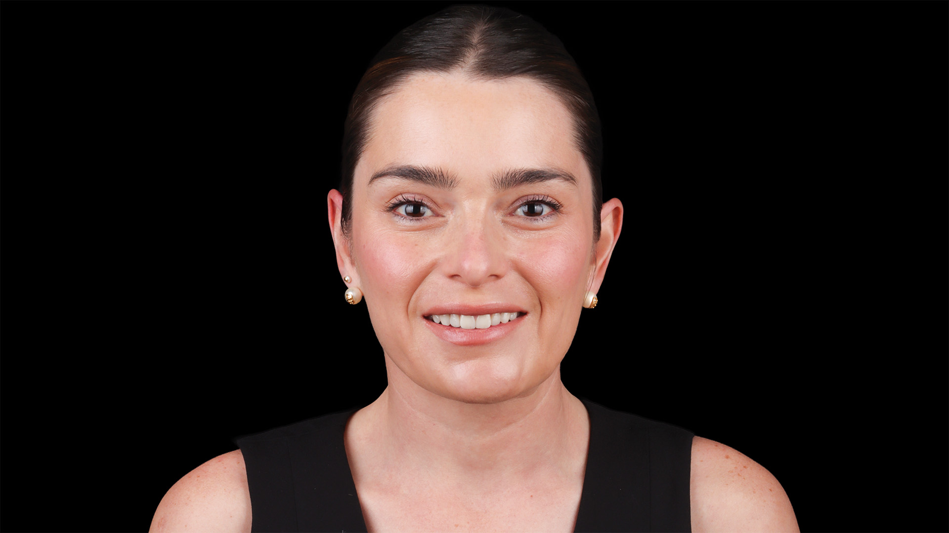 Minimal invasiv behandling ved bruk av Prettau Skin-fasetter i ...